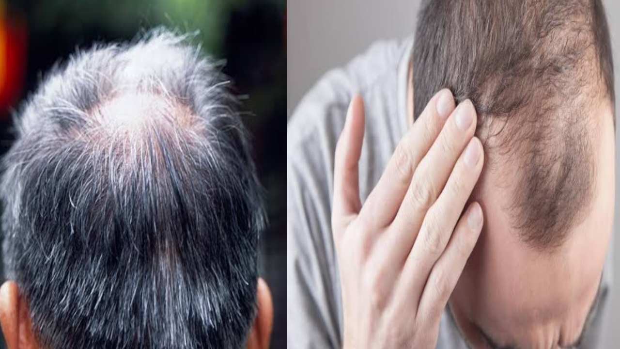 Hair Falling Problem? Here's What's Going On (and How to Fix It)